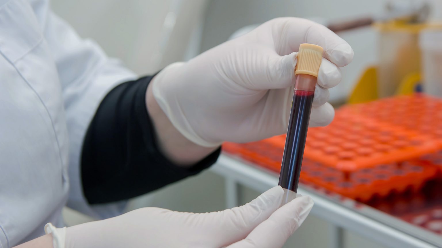 ”Skräp-dna” förklarar skillnaden mellan människa och schimpans ...